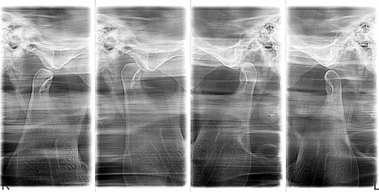 Snimanje zuba - 3D radiogram i ortopan | C Dental Centar